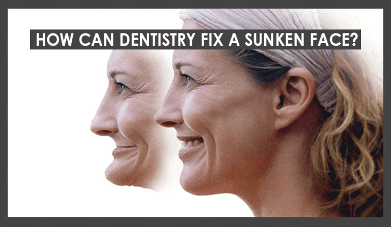 Sunken Face: How Multiple Missing Teeth Affect Your Face – Trust Dental ...